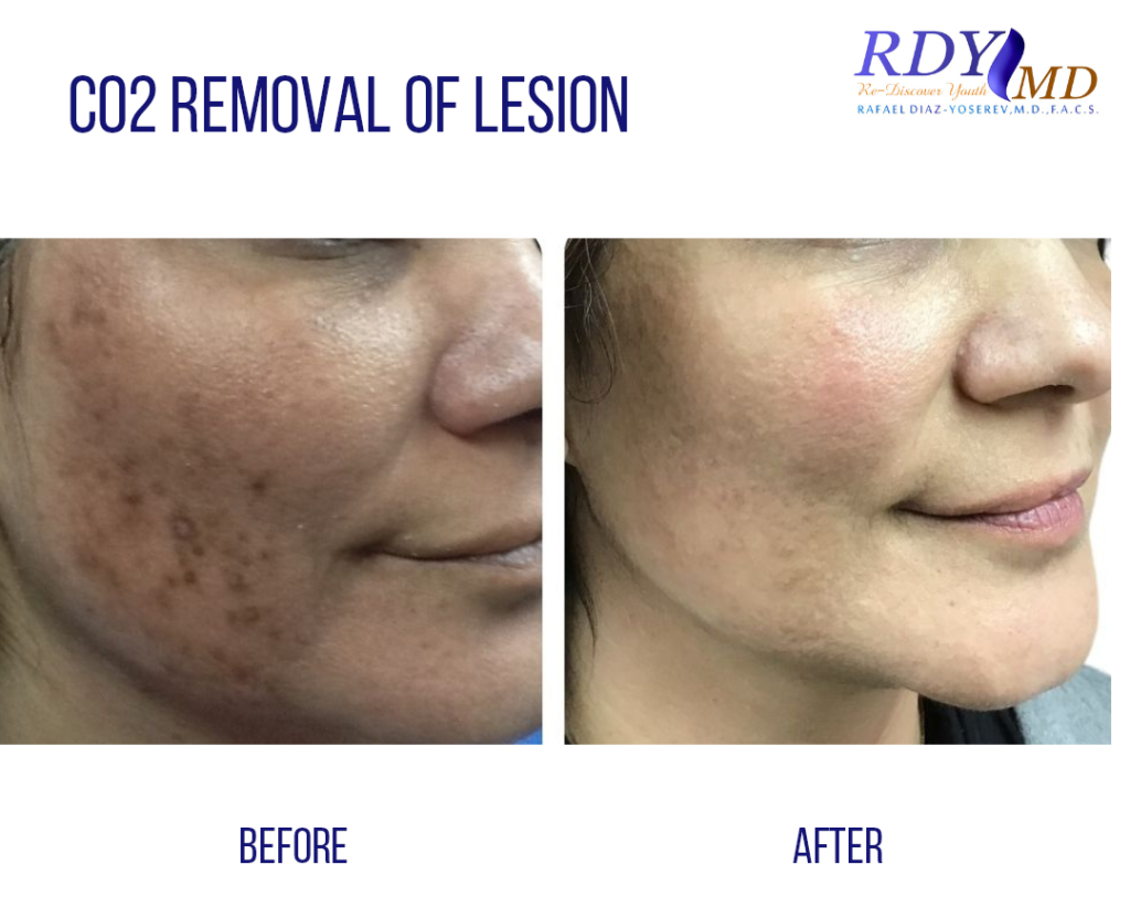 RDYMD Coral Gables Miami Med Spa