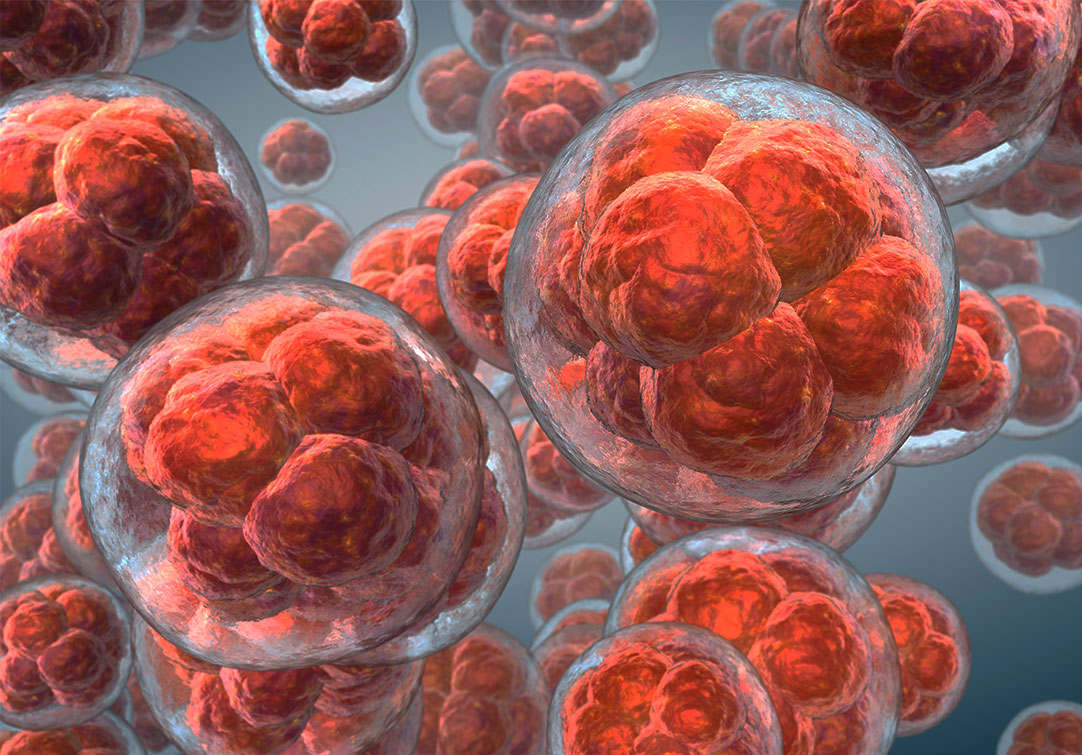 STEM CELLS HEALING POWER AT RDYMD